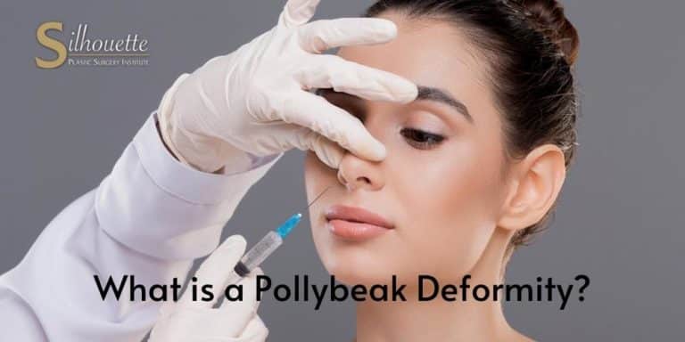 Pollybeak Deformity Rhinoplasty | Pollybeak Deformity Treatment